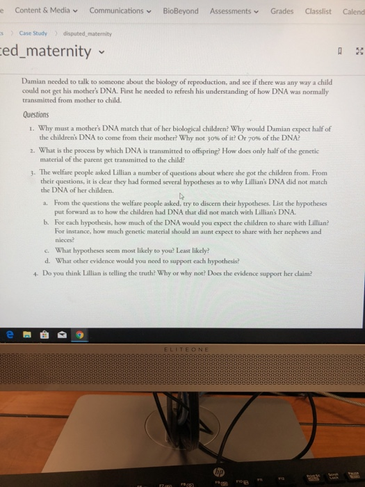 Solved Case Study disputed_maternity _maternity her cheek | Chegg.com