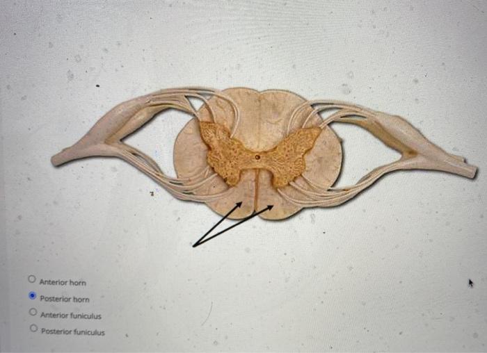 Solved O Anterior horn Posterior hom Anterior funiculus O | Chegg.com