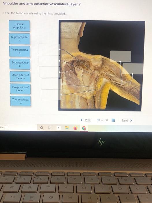 Solved Shoulder and arm posterior vasculature layer 7 Label | Chegg.com