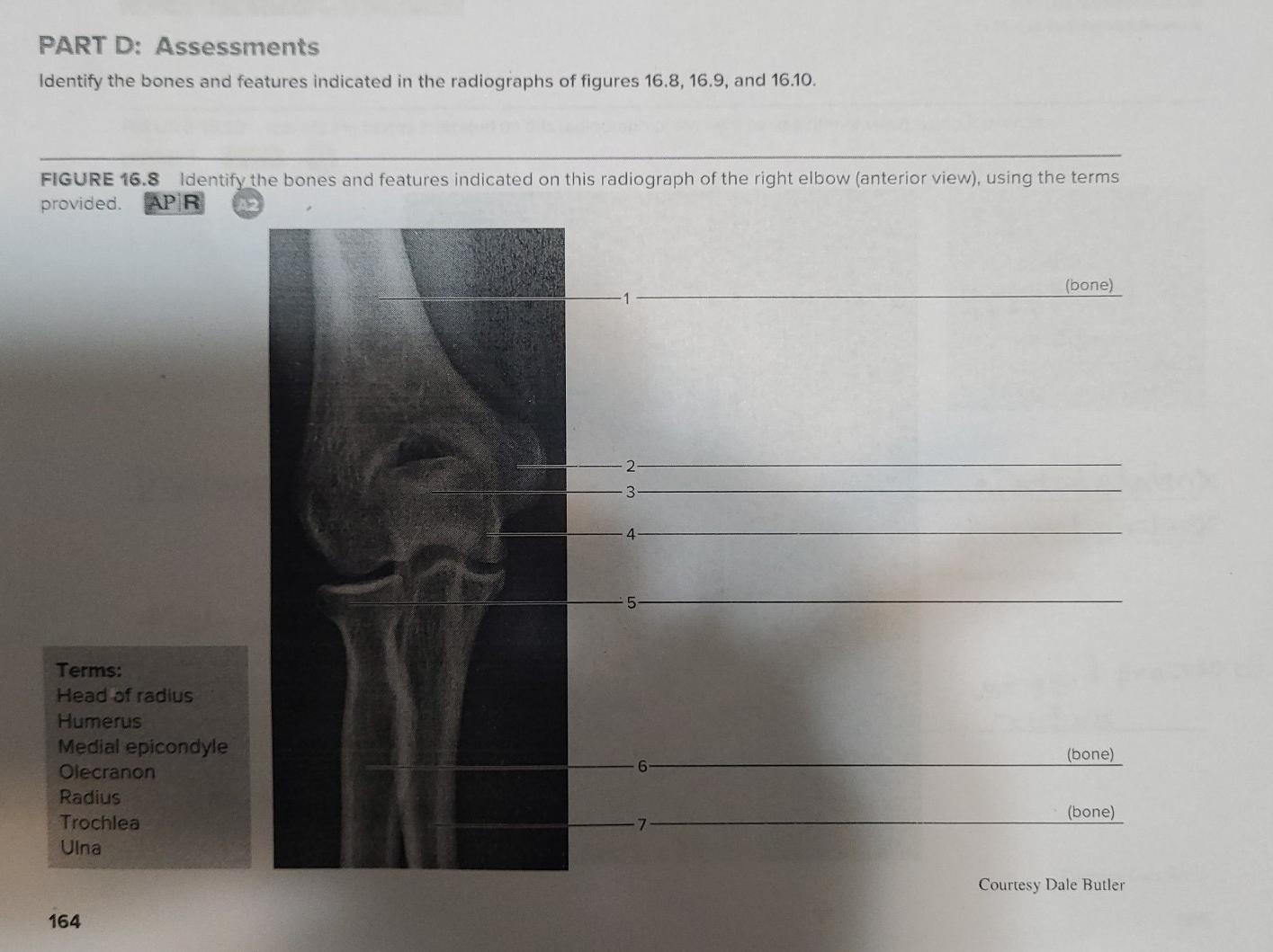 Solved PART D: Assessments Identify the bones and features | Chegg.com