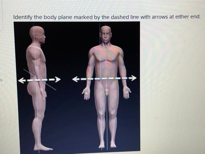 Solved Identify the body plane marked by the dashed line | Chegg.com
