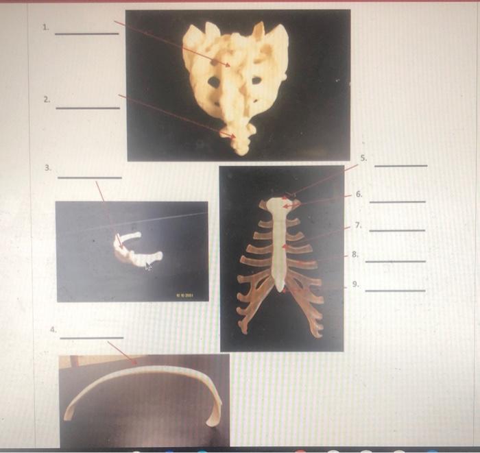 rib body jugular notch costal cartilage xiphoid | Chegg.com