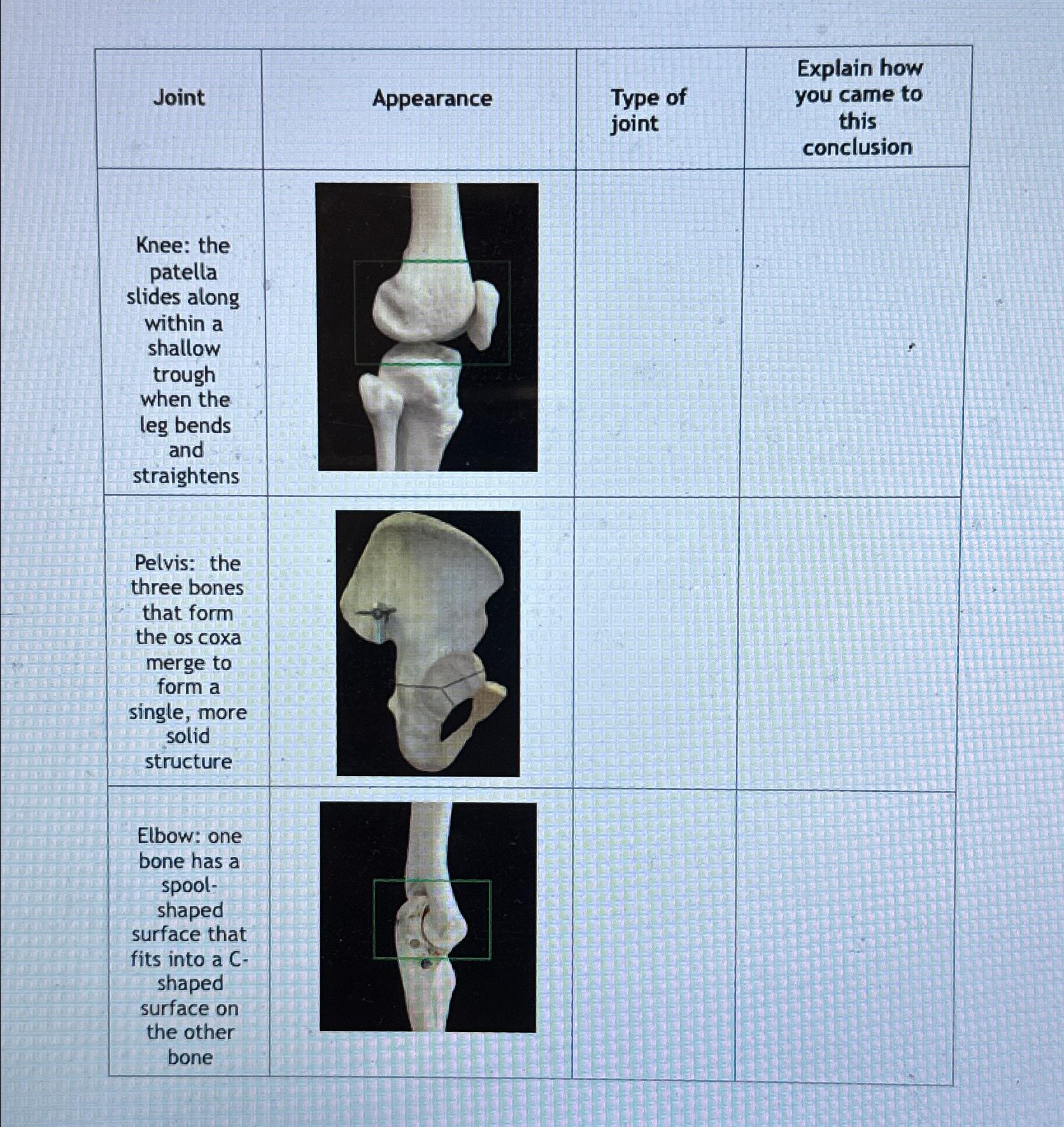 Solved Pageadjacent boneSaddle and condylar joints: similar | Chegg.com