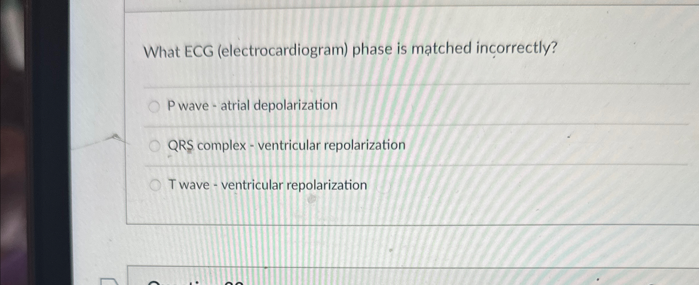 Solved What ECG (electrocardiogram) ﻿phase is matched | Chegg.com