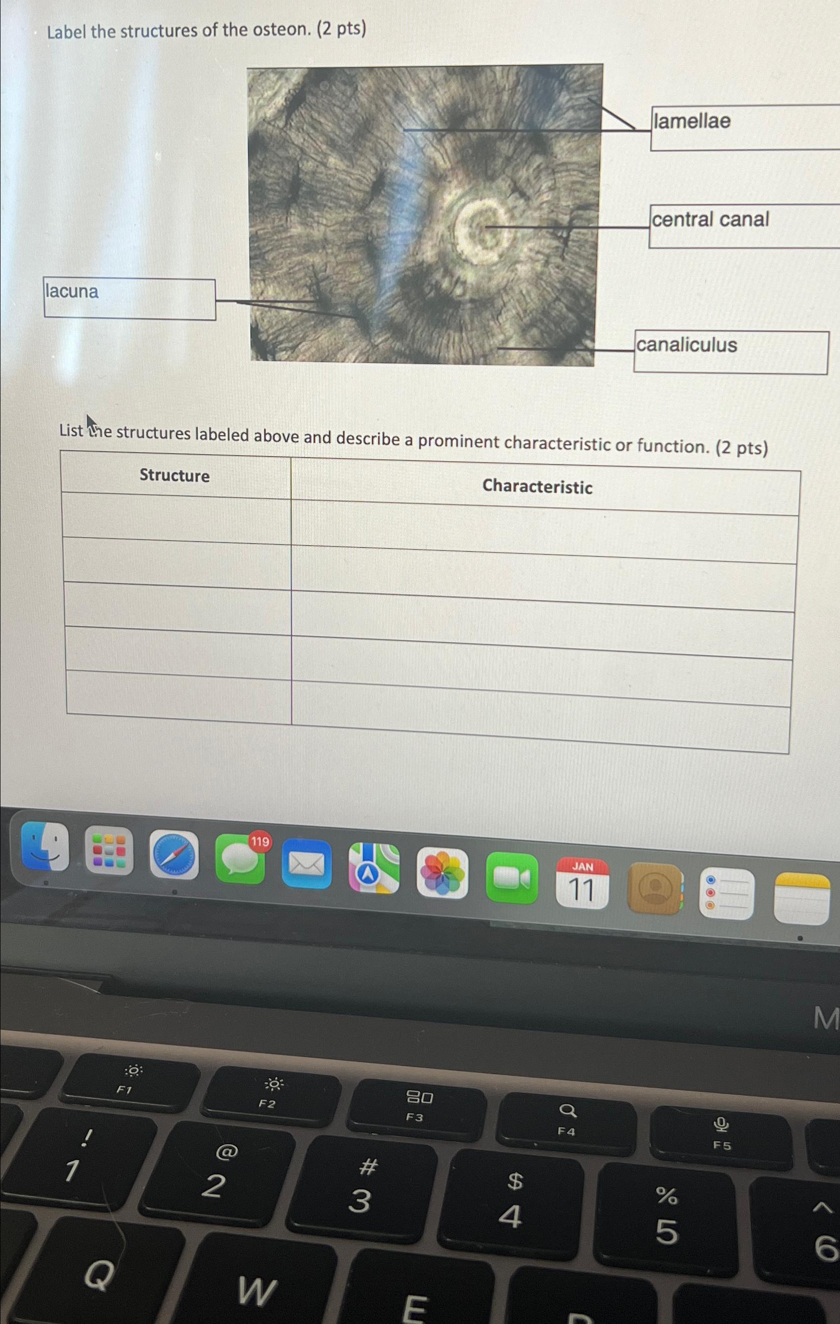 Solved Label the structures of the osteon. (2 ﻿pts)List the | Chegg.com
