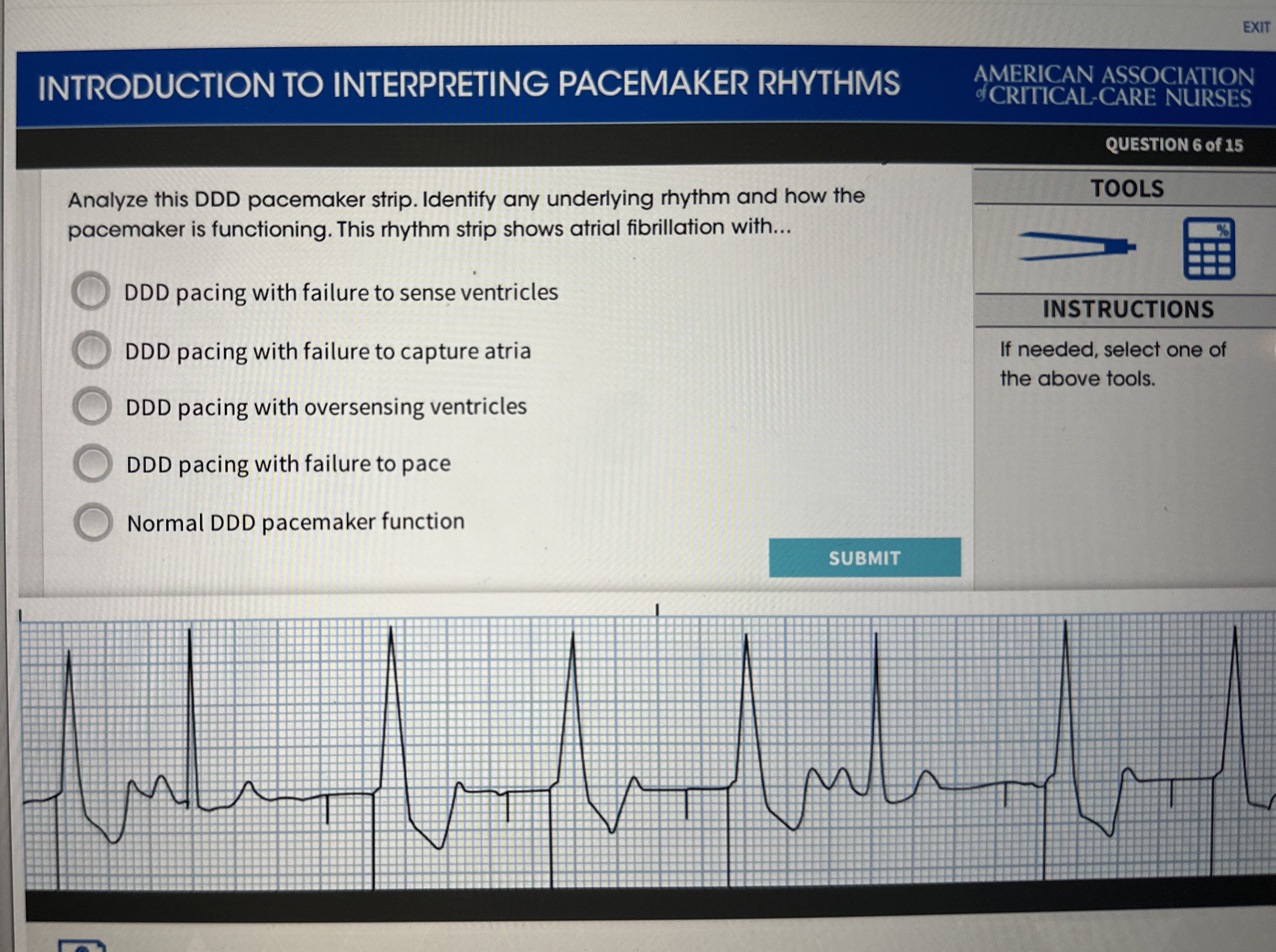 Solved INTRODUCTION TO INTERPRETING PACEMAKER | Chegg.com
