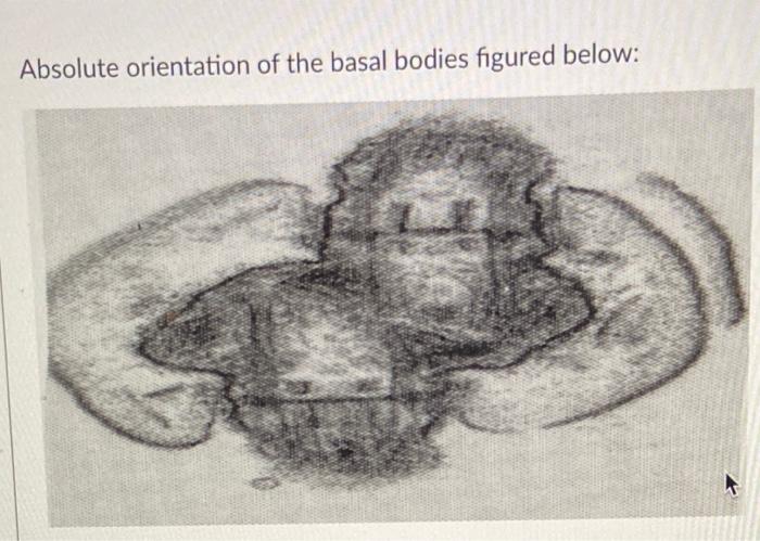 Absolute orientation of the basal bodies figured | Chegg.com