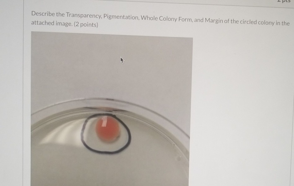 Solved Describe the Transparency, Pigmentation, Whole Colony | Chegg.com
