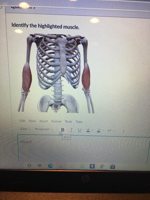 Solved UO. Identify the highlighted muscle. Edit View Insert | Chegg.com