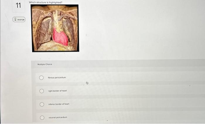 Solved Muejple Croice tepous pericesdum roha border of heart | Chegg.com