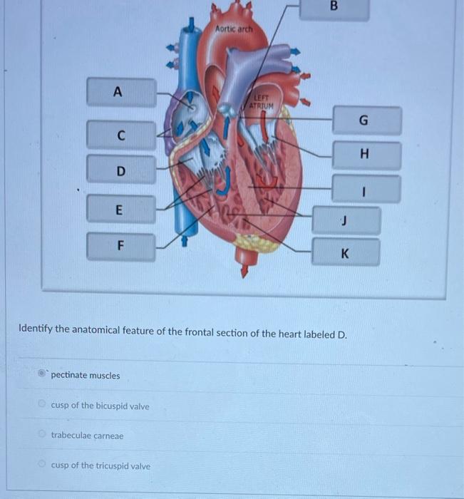 Solved Identify the anatomical feature of the frontal | Chegg.com