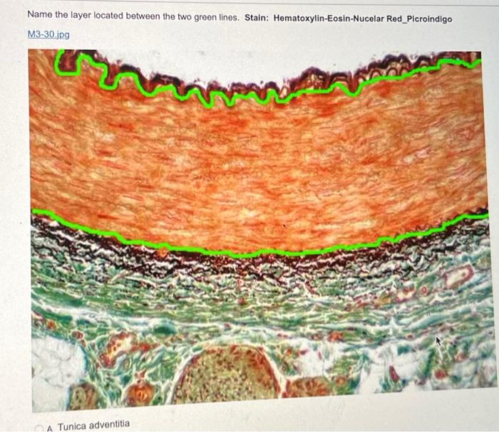 Solved Name the layer located between the two green lines. | Chegg.com