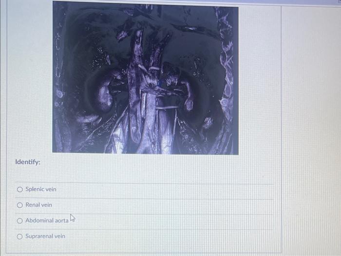 Solved Identify: Splenic vein Renal vein Abdominal aorta | Chegg.com