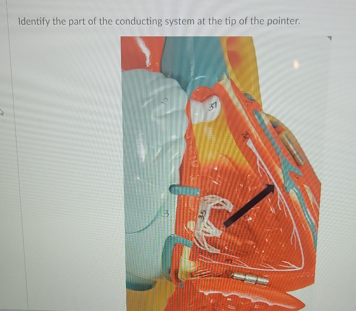 Solved Identify the part of the conducting system at the tip | Chegg.com