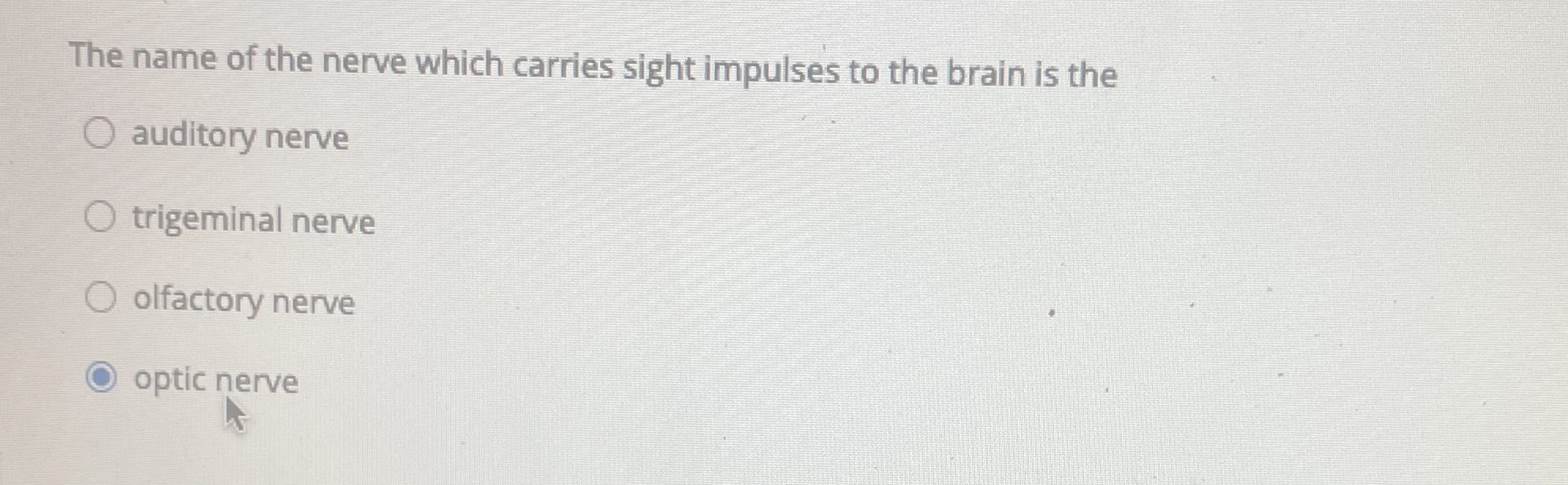 Solved The name of the nerve which carries sight impulses to | Chegg.com