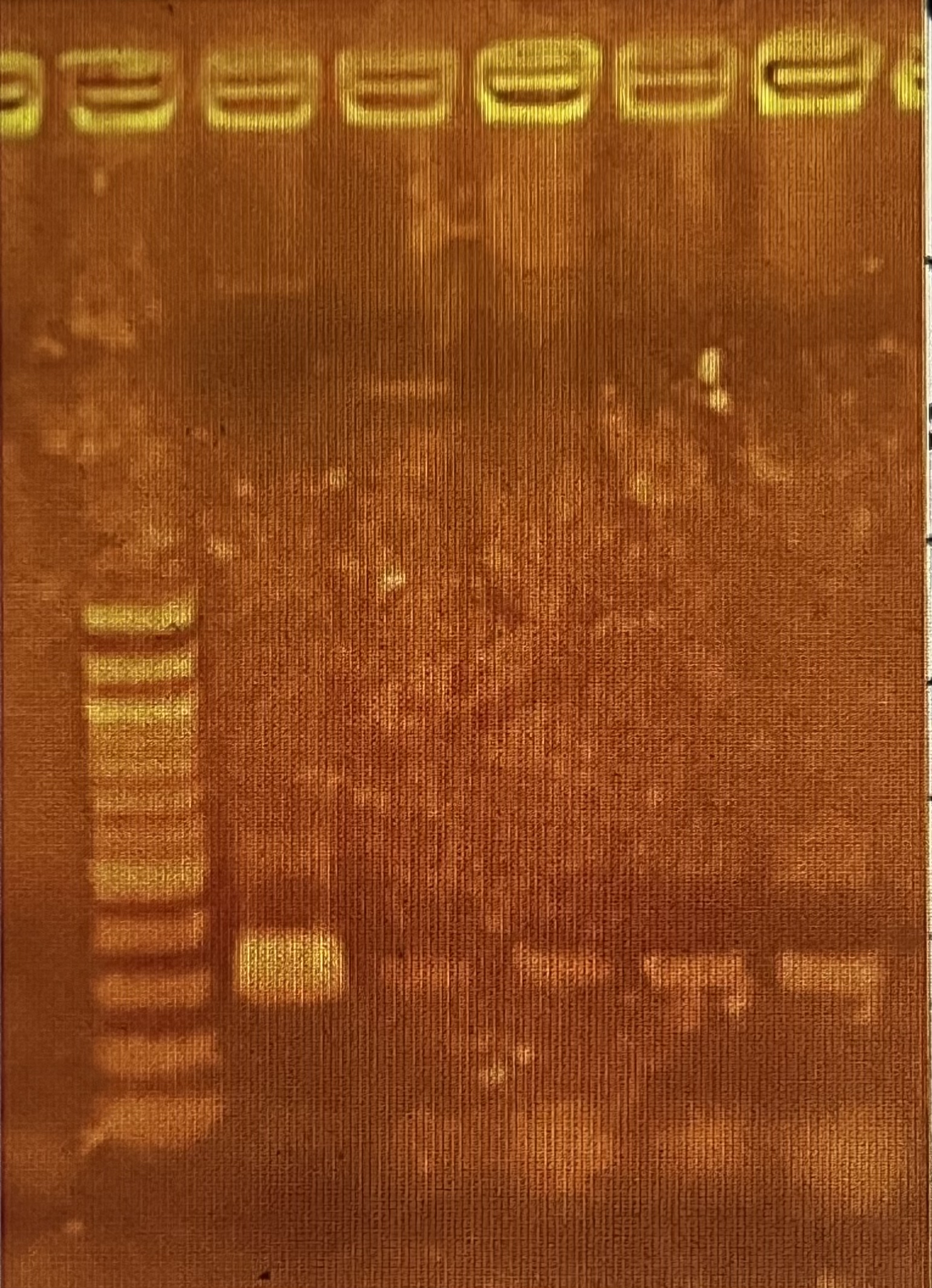 Solved Image shows: PCR products from Saccharomyces | Chegg.com