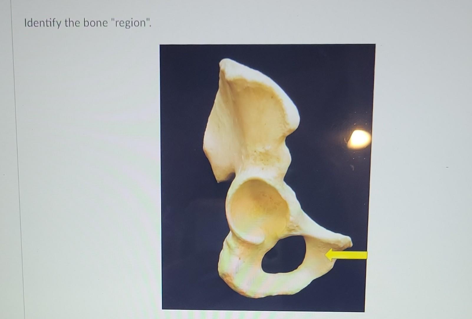 Solved Identify the bone marker indicated by the red | Chegg.com