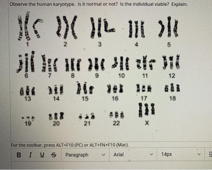 Solved Observe the human karyotype. Is it normal or not? Is | Chegg.com