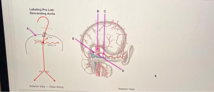 Solved Labeling Pre-Lab: Descending Aorta B C TA ALB E CH | Chegg.com