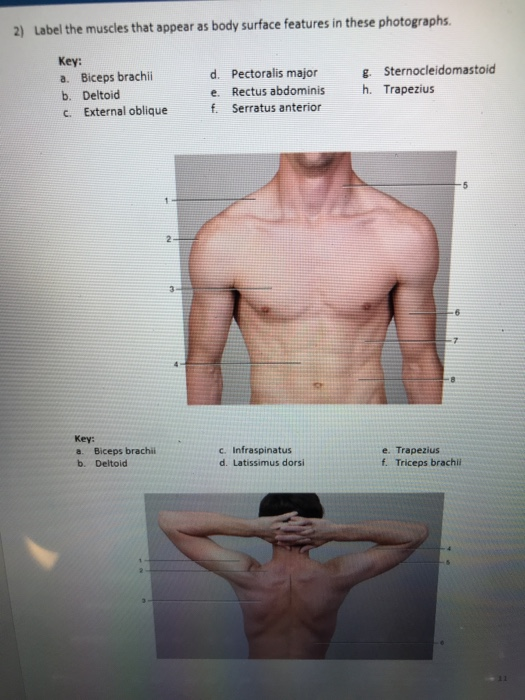 Solved 2) Label the muscles that appear as body surface | Chegg.com