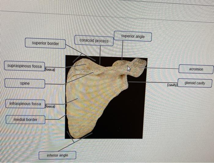Solved superior angle superior border coracoid process | Chegg.com