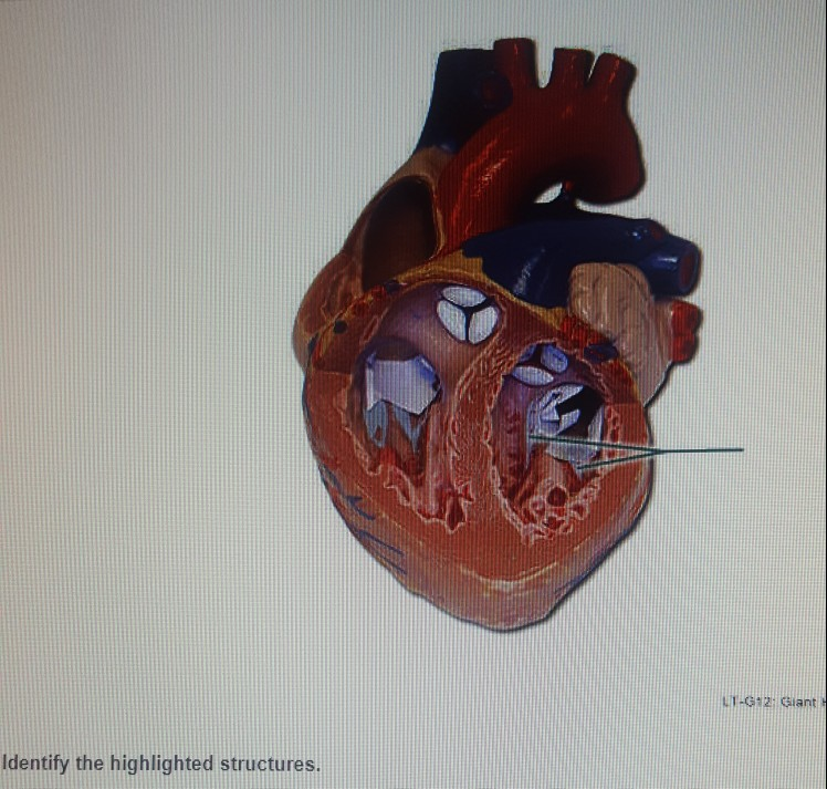 Solved 1-G92: Giant Identify the highlighted structures. | Chegg.com