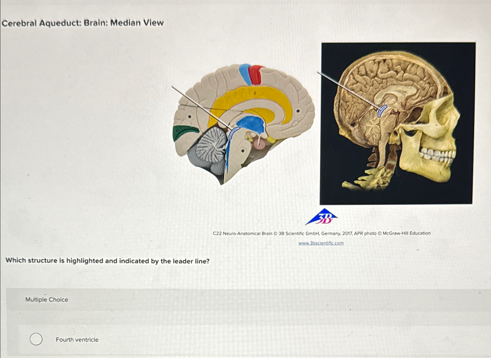 Solved Cerebral Aqueduct: Brain: Median ViewC22 | Chegg.com
