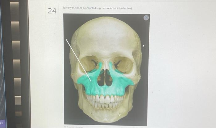 Solved 24 Identify the bone highlighted in green (reference | Chegg.com