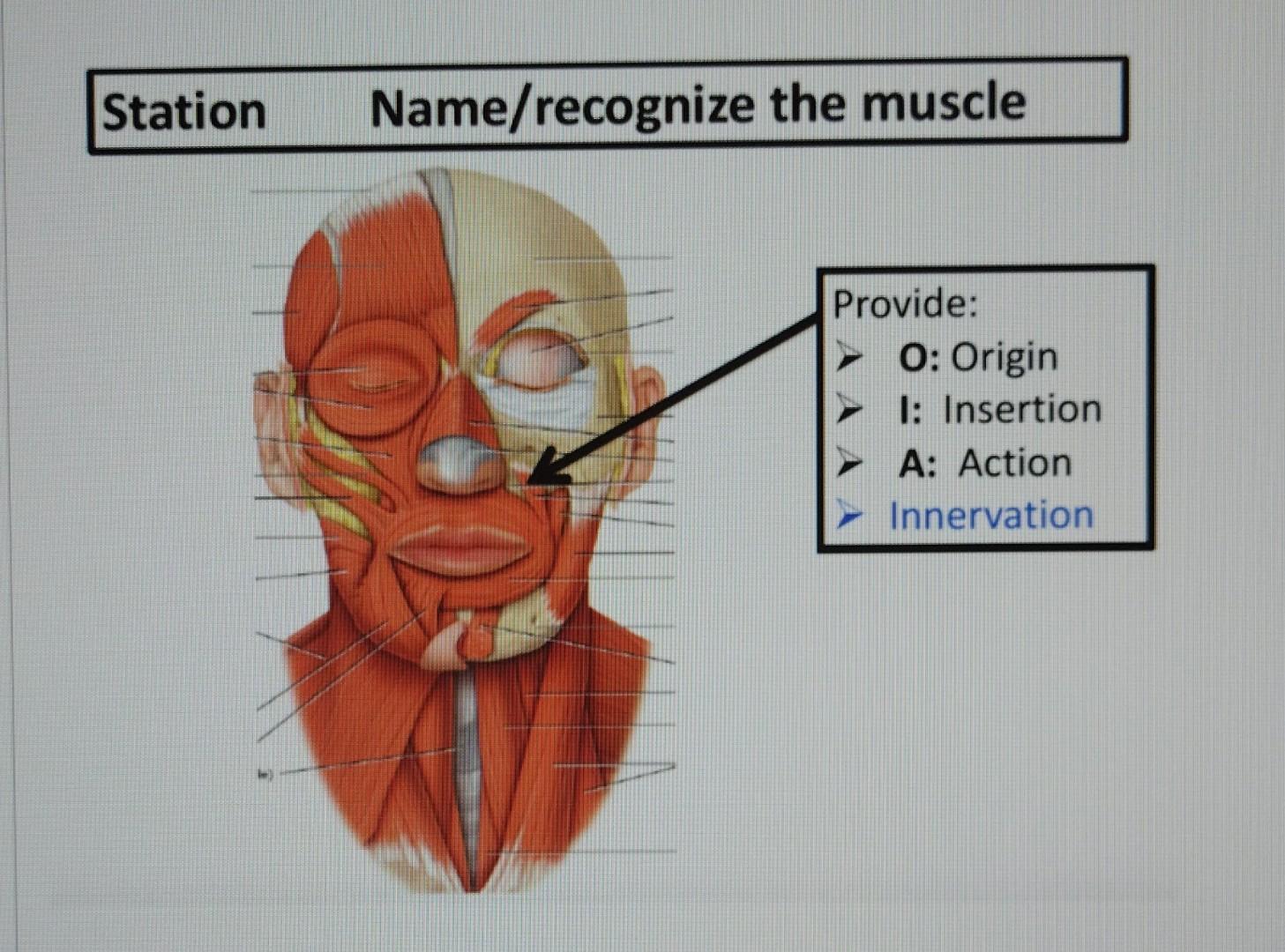 Solved Station Name/recognize the muscle | Chegg.com