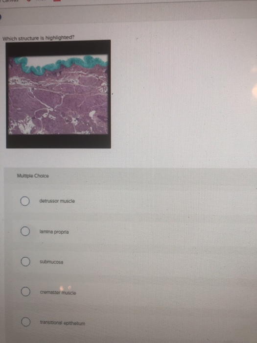 Solved Which structure is highlighted? Multiple Choice | Chegg.com