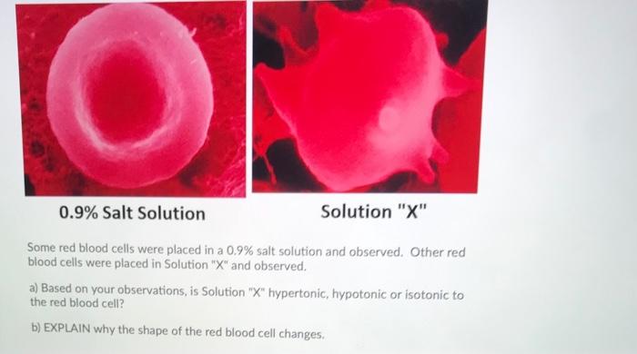 Solved 0.9% Salt Solution Solution "X" Some red blood cells | Chegg.com