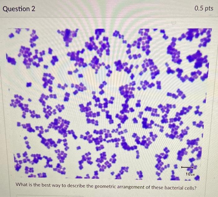 Solved You grow colonies of Escherichia coli and Pseudomonas | Chegg.com