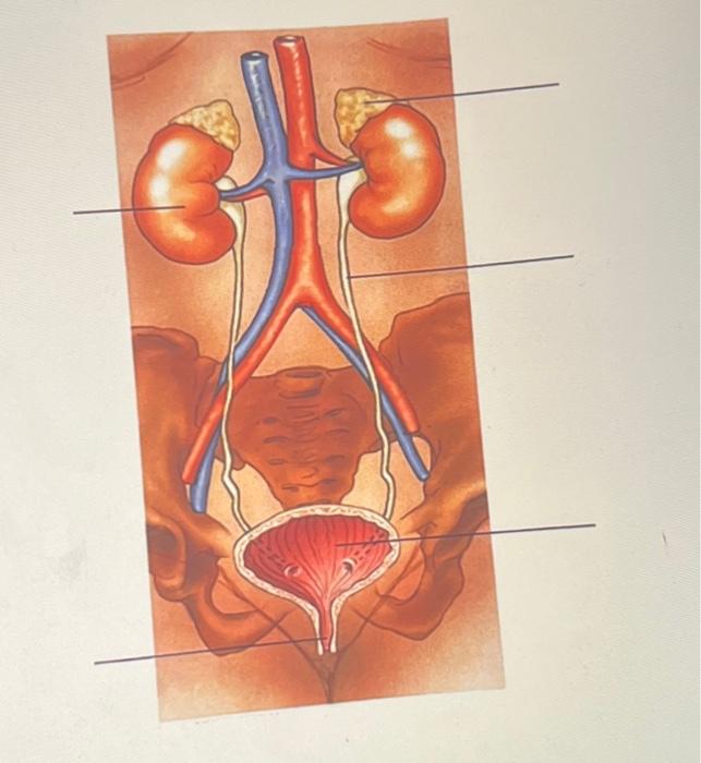 Solved Label the diagrams. Thank you! | Chegg.com