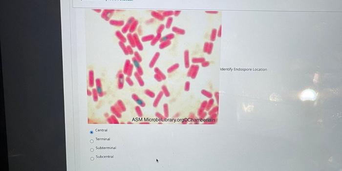 Solved Identify Endospore Location ASM MicrobeLibrary.org | Chegg.com