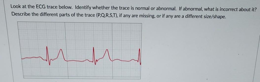 Solved Look at the ECG trace below. Identify whether the | Chegg.com