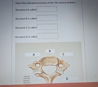Solved Name the indicated structures of this 7th cervical | Chegg.com