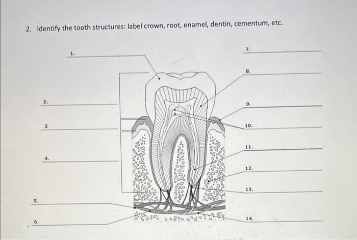 1. Directional terminology: label the directional | Chegg.com