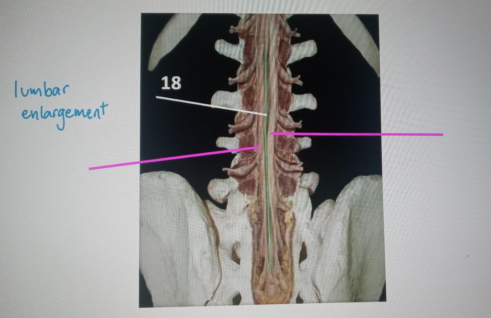 Solved Please label the structures pointed by all the black | Chegg.com