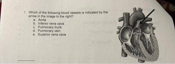 Solved 1. Which of the following blood vessels is indicated | Chegg.com