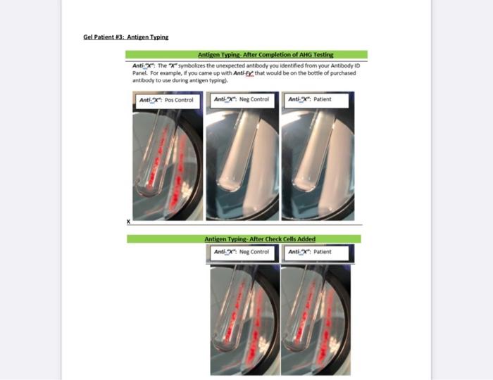 Patient ab: Giel] Date Tested: Mn Number rogecel. | Chegg.com