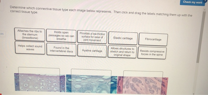 Solved Check my work Determine which connective tissue type | Chegg.com
