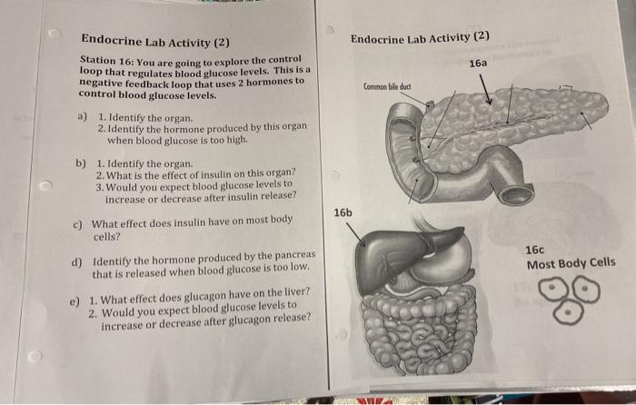 Solved Endocrine Lab Activity 2 Endocrine Lab Activity 2