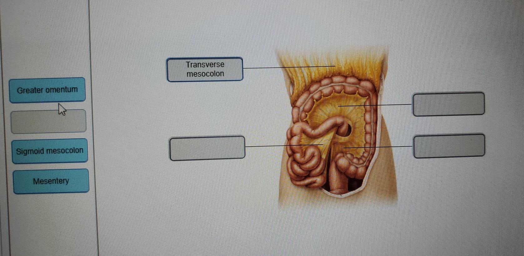 Solved Transverse mesocolon Greater omentum 10 Sigmoid | Chegg.com