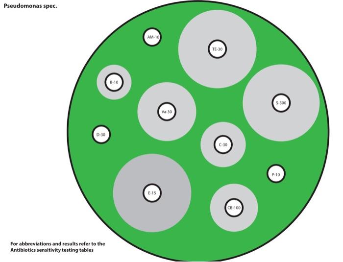 5) Measure the diameter of the Zone of Inhibition | Chegg.com