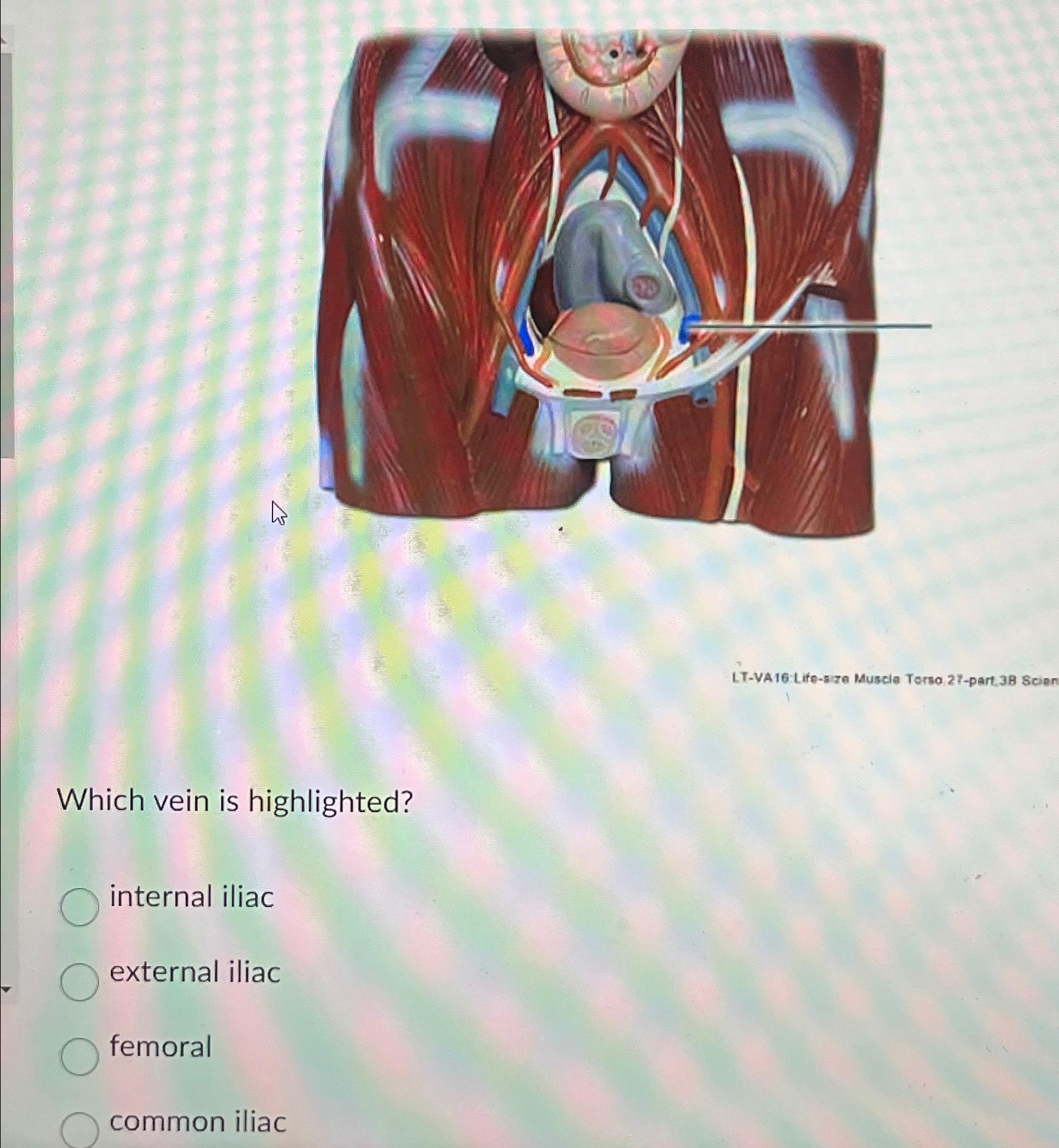 Solved Which vein is highlighted?internal iliacexternal | Chegg.com