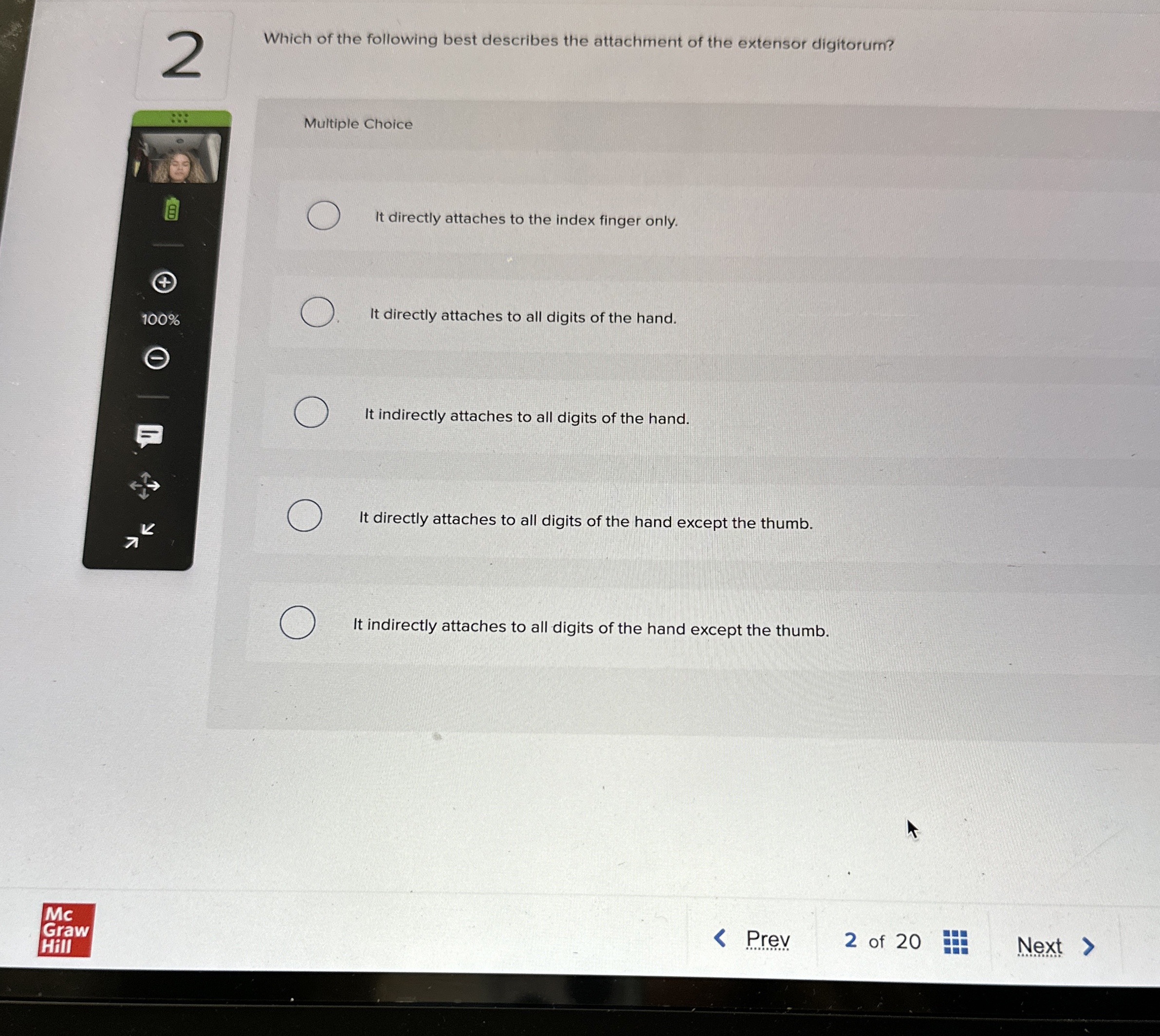 Solved 2Which of the following best describes the attachment | Chegg.com