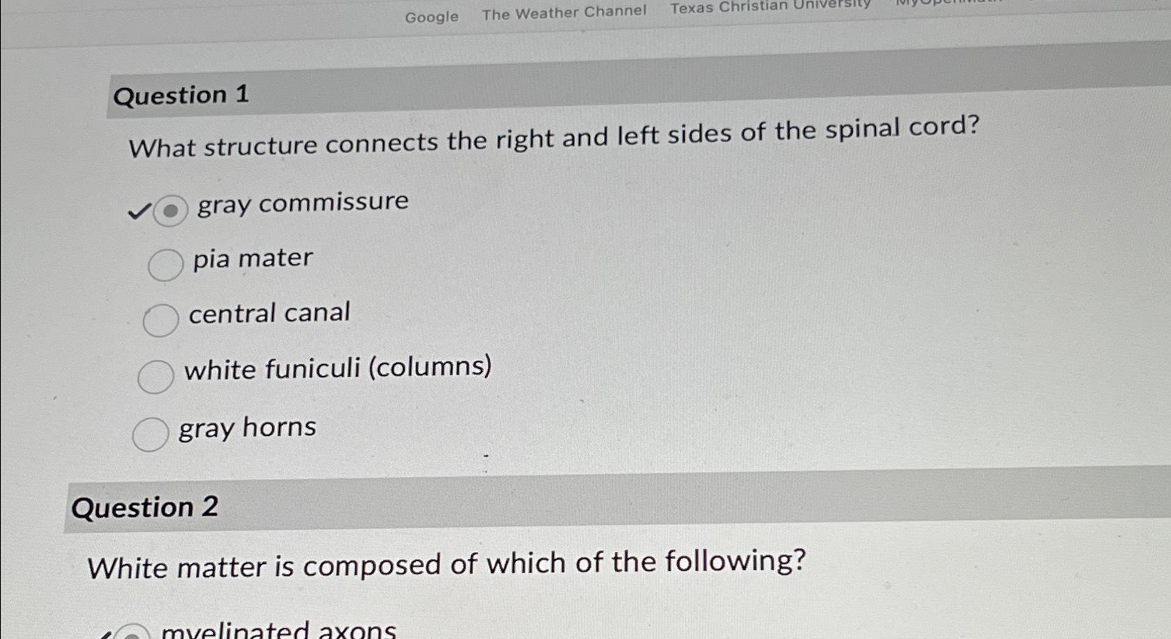 Solved Question 1What structure connects the right and left | Chegg.com