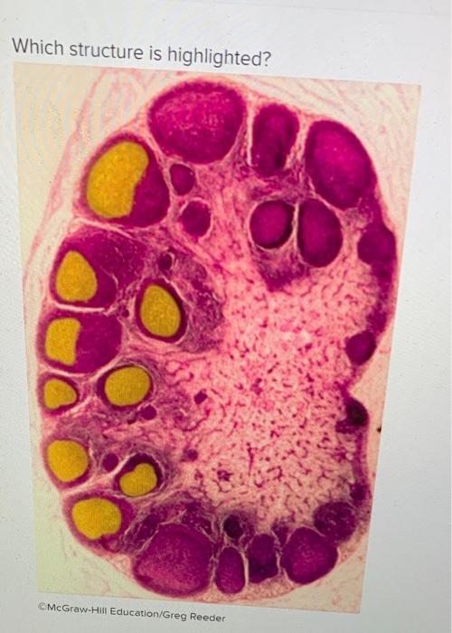 Solved Which structure is highlighted? McGraw-Hill | Chegg.com