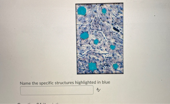 Solved Name the specific structures highlighted in blue 11 | Chegg.com