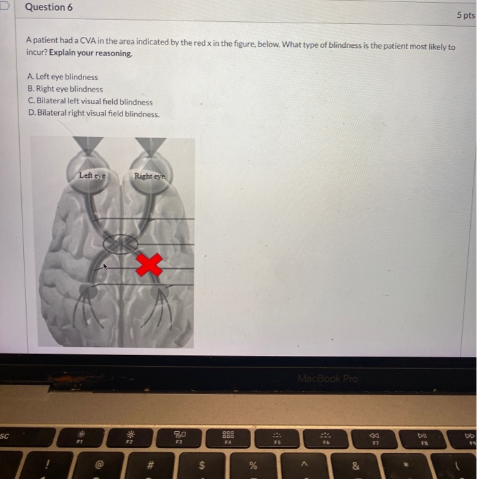Solved Question 6 5 pts A patient had a CVA in the area | Chegg.com